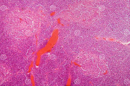 Cells of a Human Thymus Gland Under the Microscope Stock Photo - Image ...