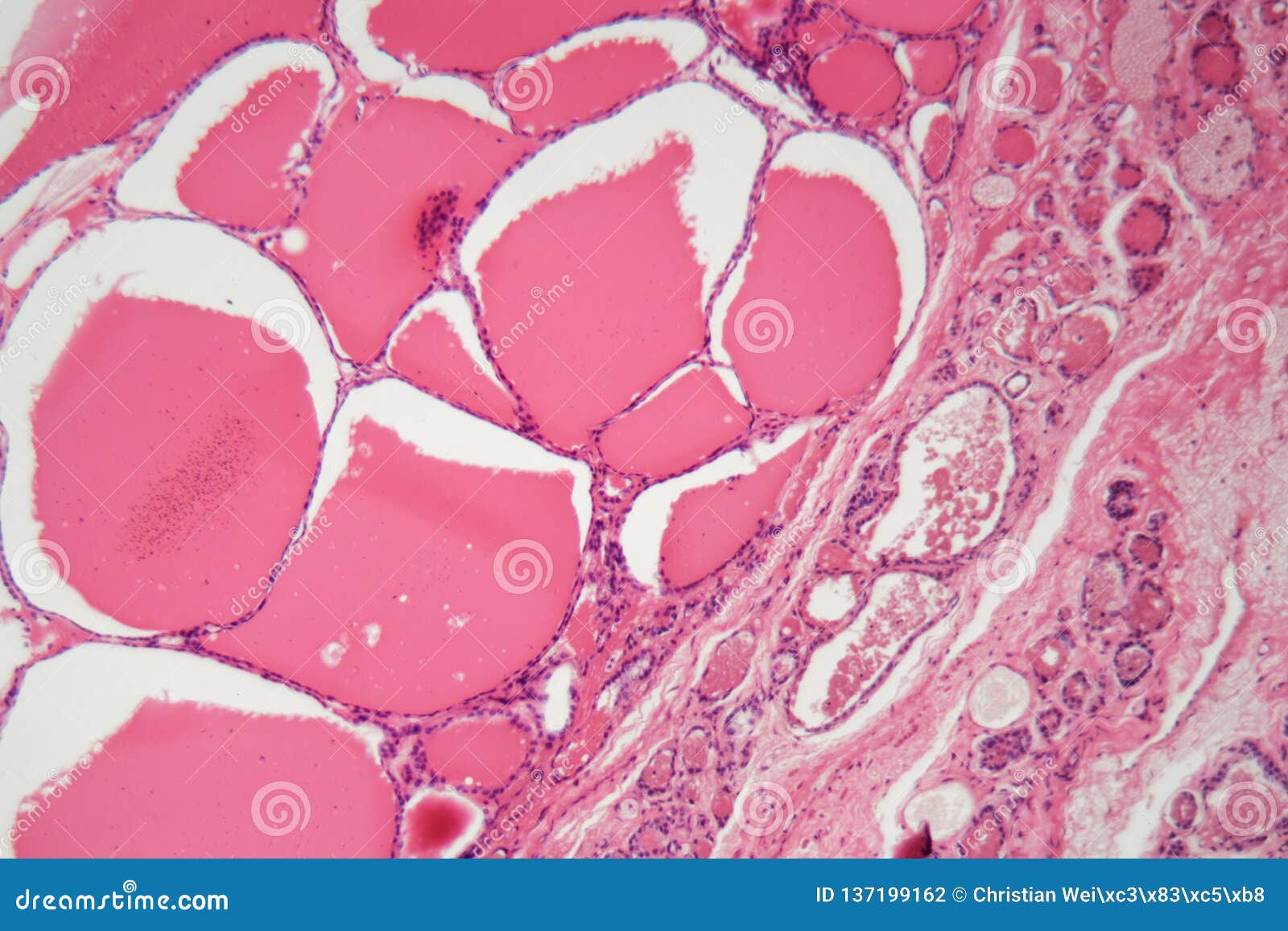 Human Heart Cells Under Microscope Micropedia Cardiac Muscle Tissue