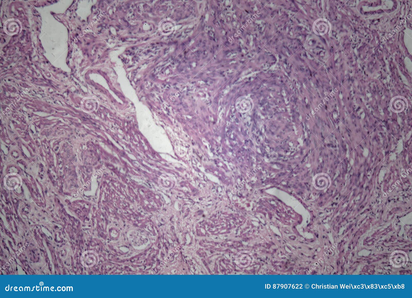 Histology Of The Uterus Stock Photography | CartoonDealer.com #49104002