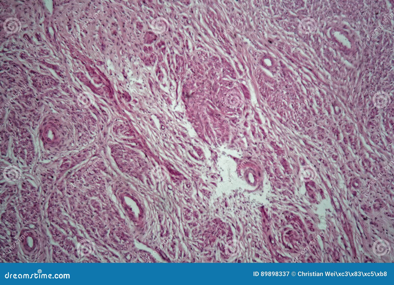 Histology Of The Uterus Stock Photography | CartoonDealer.com #49104002