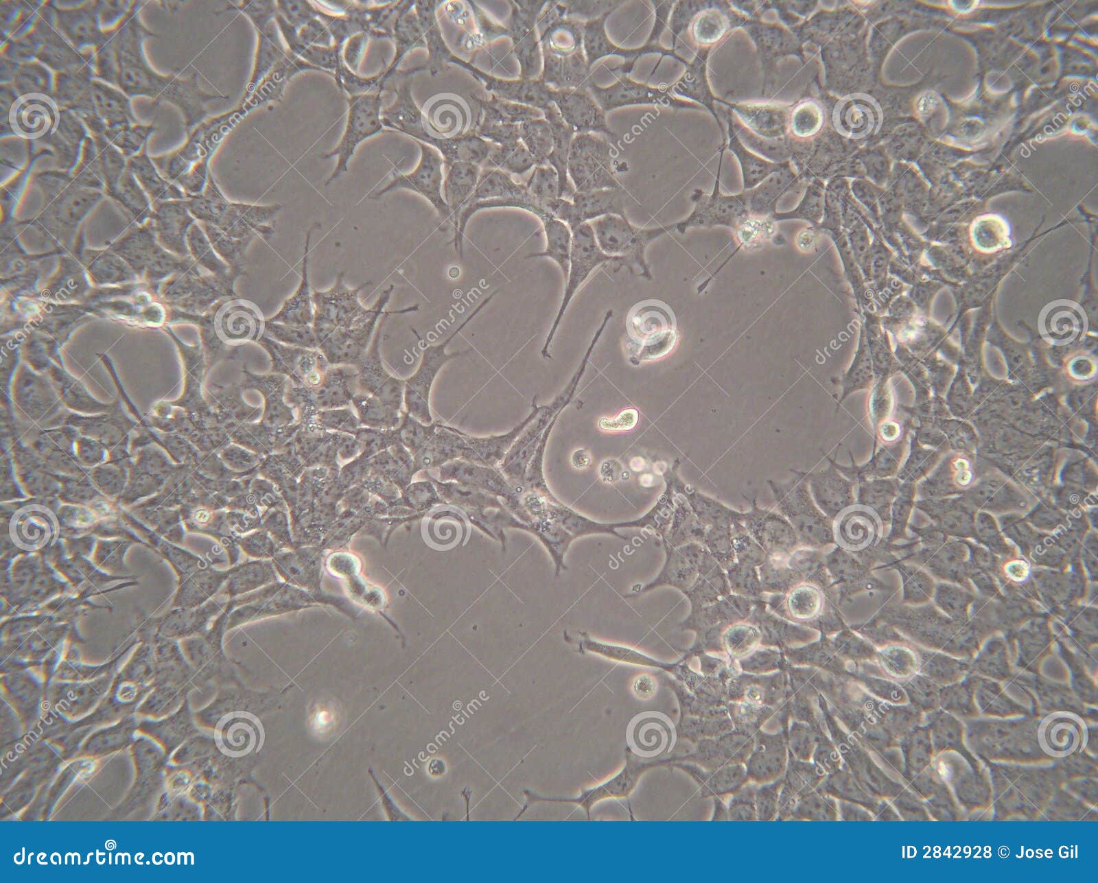 Cells in a Microscope 2 stock photo. Image of fibroblasts - 2842928
