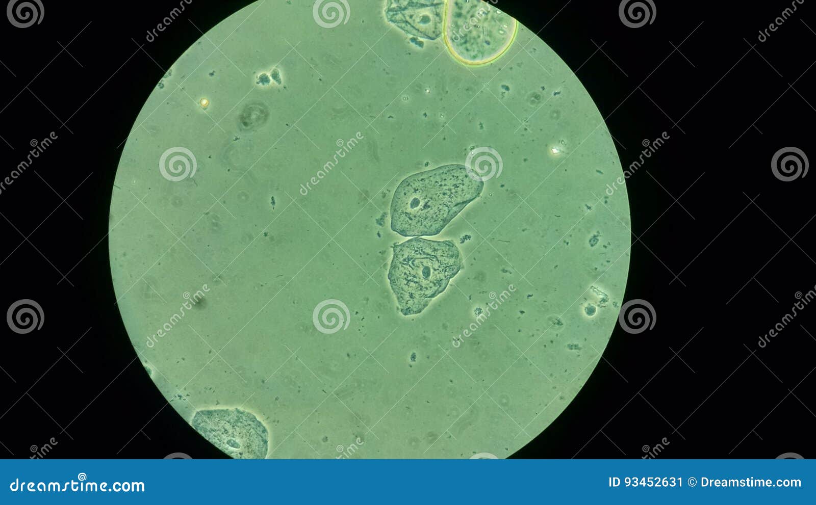 Cells on a Microscope stock image. Image of human, nucleo - 93452631