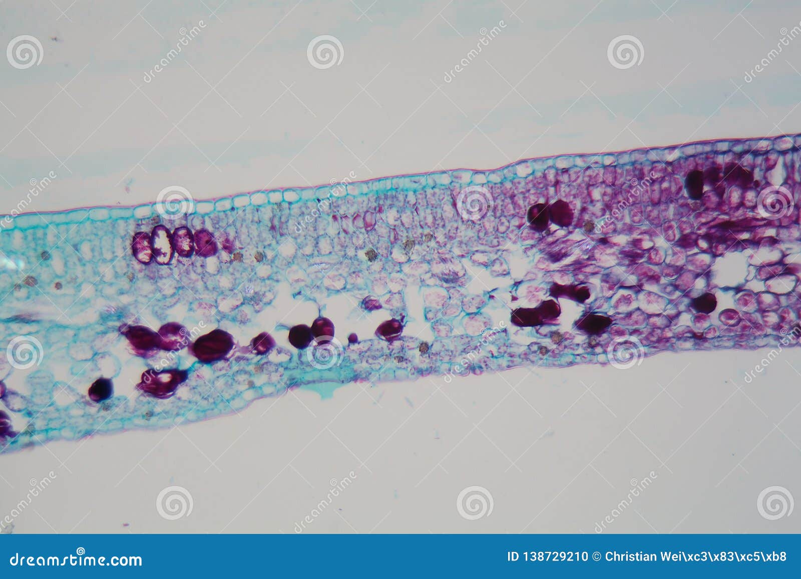 Cells Of A Plant Leaf With Damaged Epidermis And Chloroplasts Under A ...