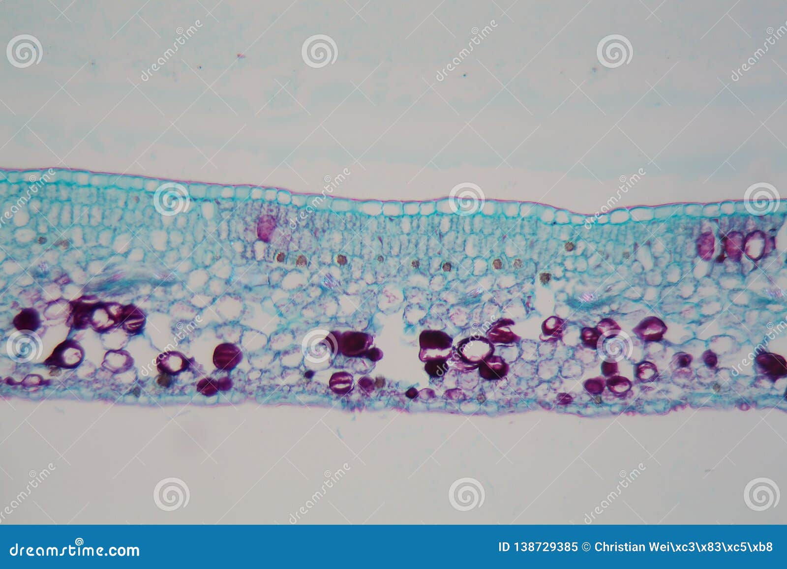 Plant Epidermis Microscope