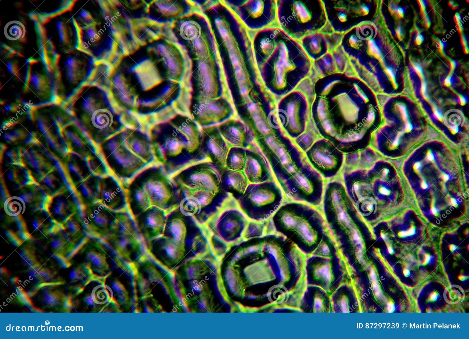 Cells in the yew needle stock image. Image of medical - 87297239