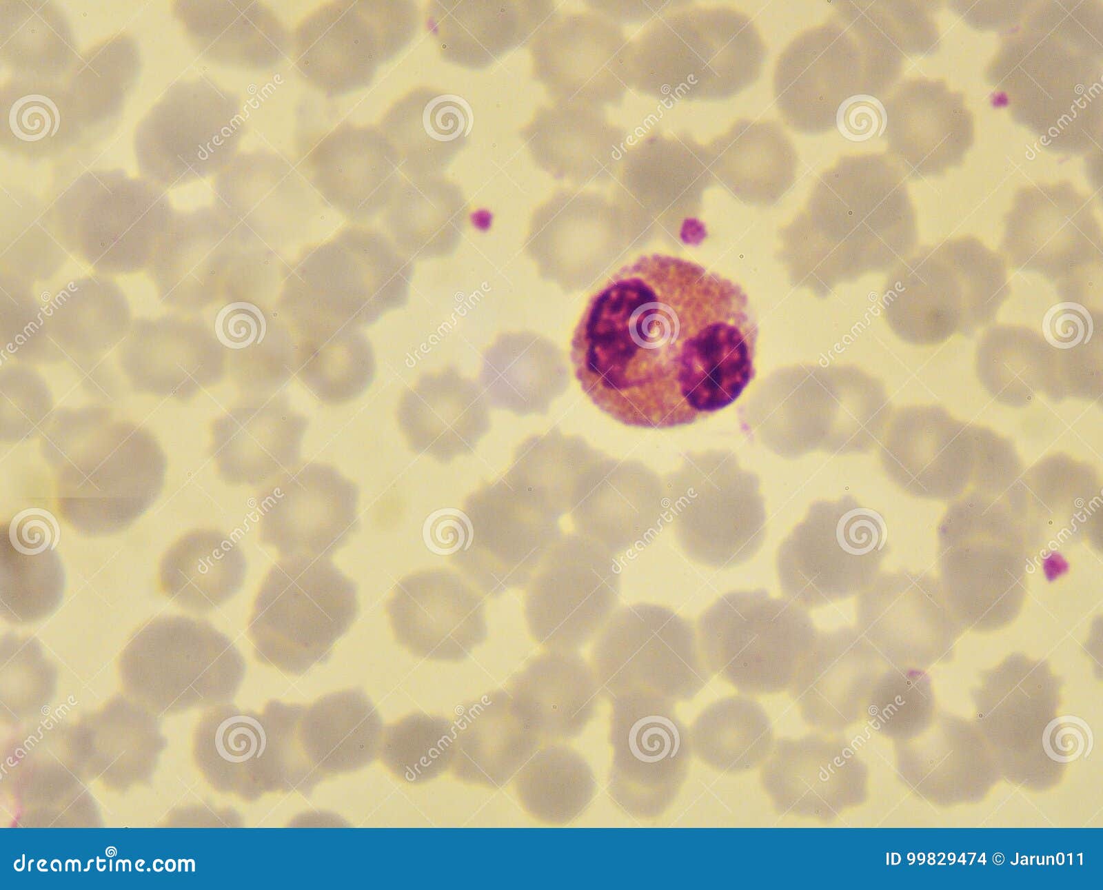 Cellule éosinophile photo stock. Image du blanc, érythrocytes - 99829474