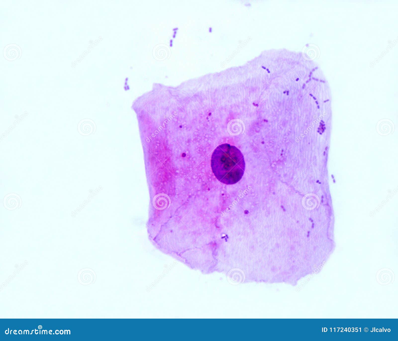 Cellule épithéliale Squamous Image stock - Image du cellules ...