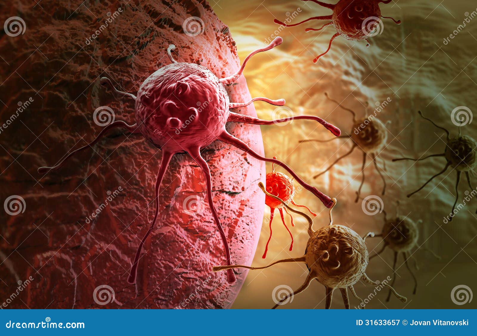 Cellule cancéreuse illustration stock. Illustration du estomac - 31633657
