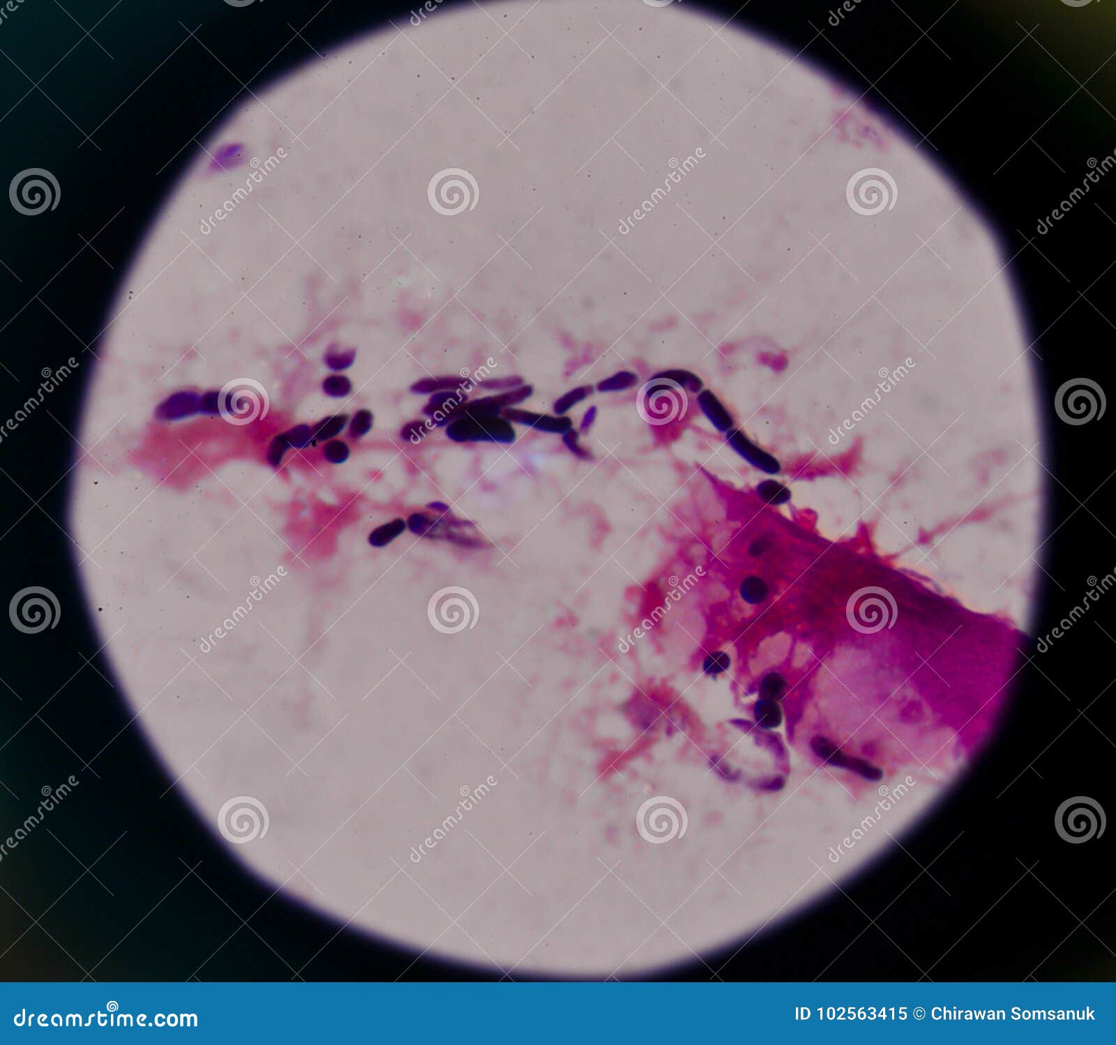 Cellule De Levure De Bourgeonnement Dans La Méthode De Tache De Gramme ...