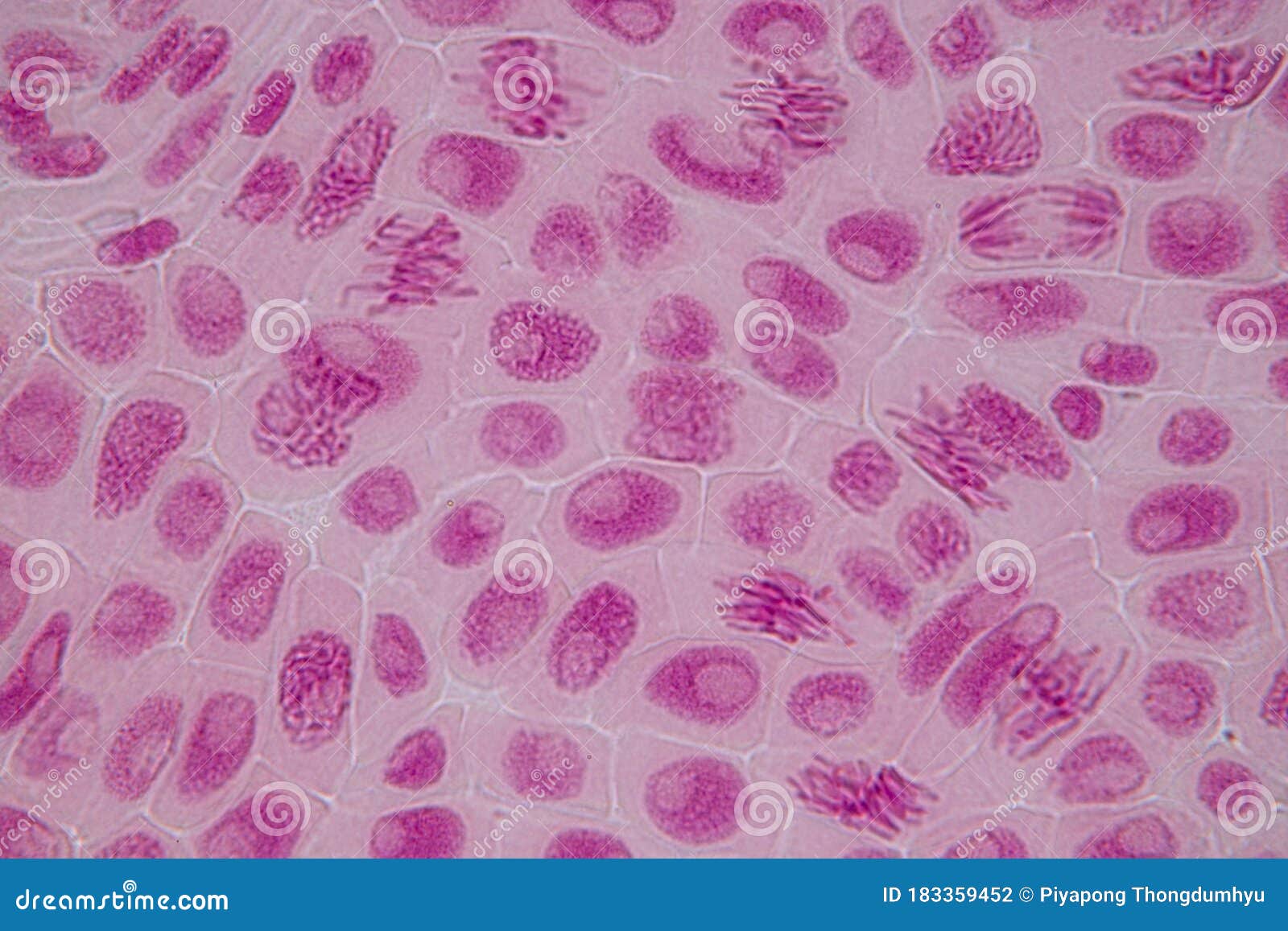 Cellule De Mitose Dans La Pointe De Racine De L'oignon Au Microscope. Photo stock - Image du ...