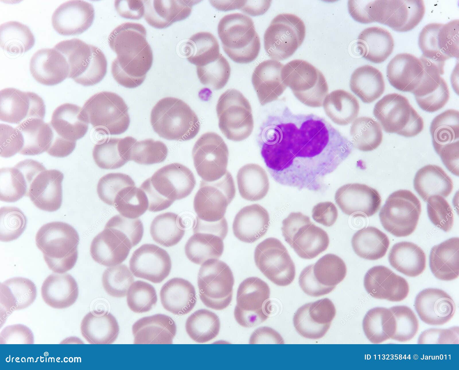 Cellule De Monocyte Dans La Calomnie De Sang Photo stock - Image of ...