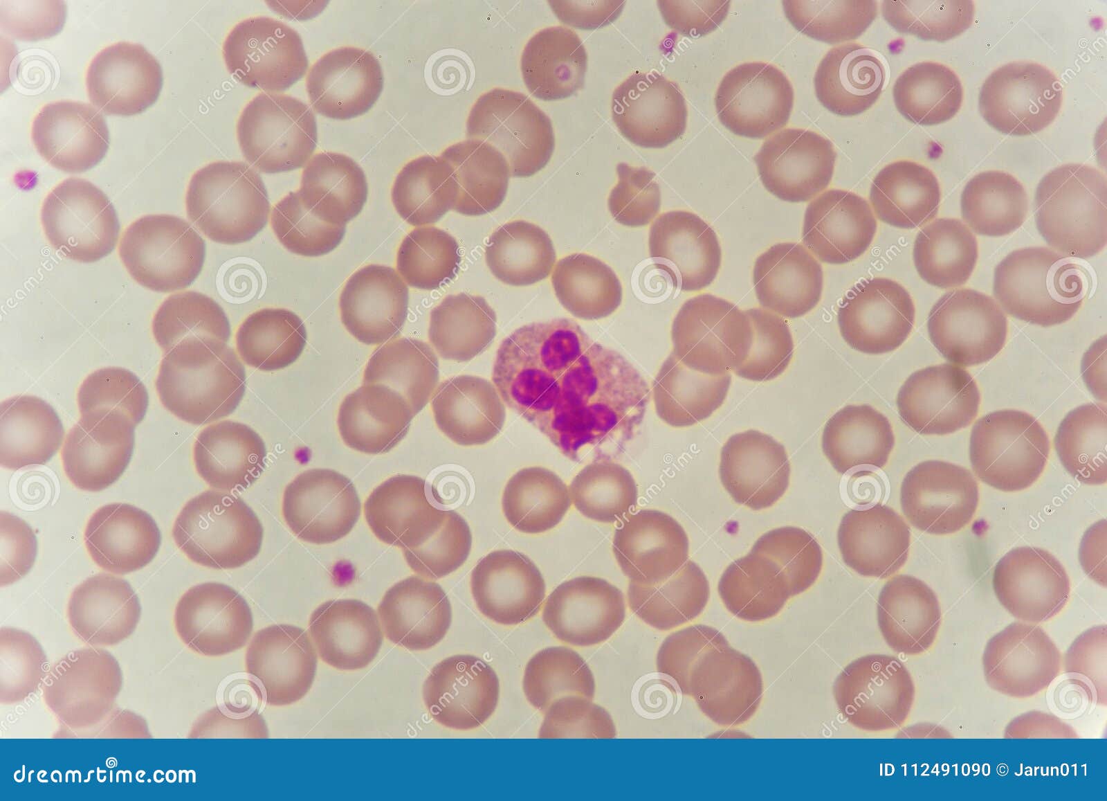 Cellule De Neutrophile Dans La Calomnie De Sang Photo stock - Image du ...