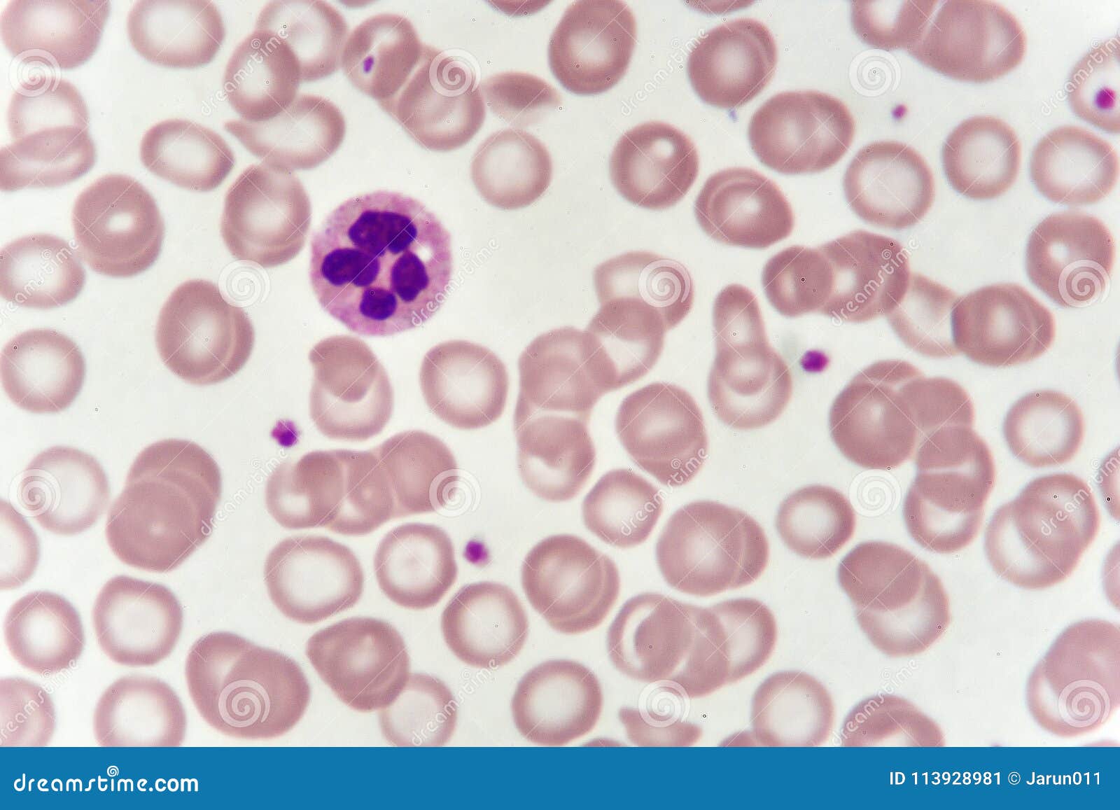 Cellule De Neutrophile Dans La Calomnie De Sang Image stock - Image du ...