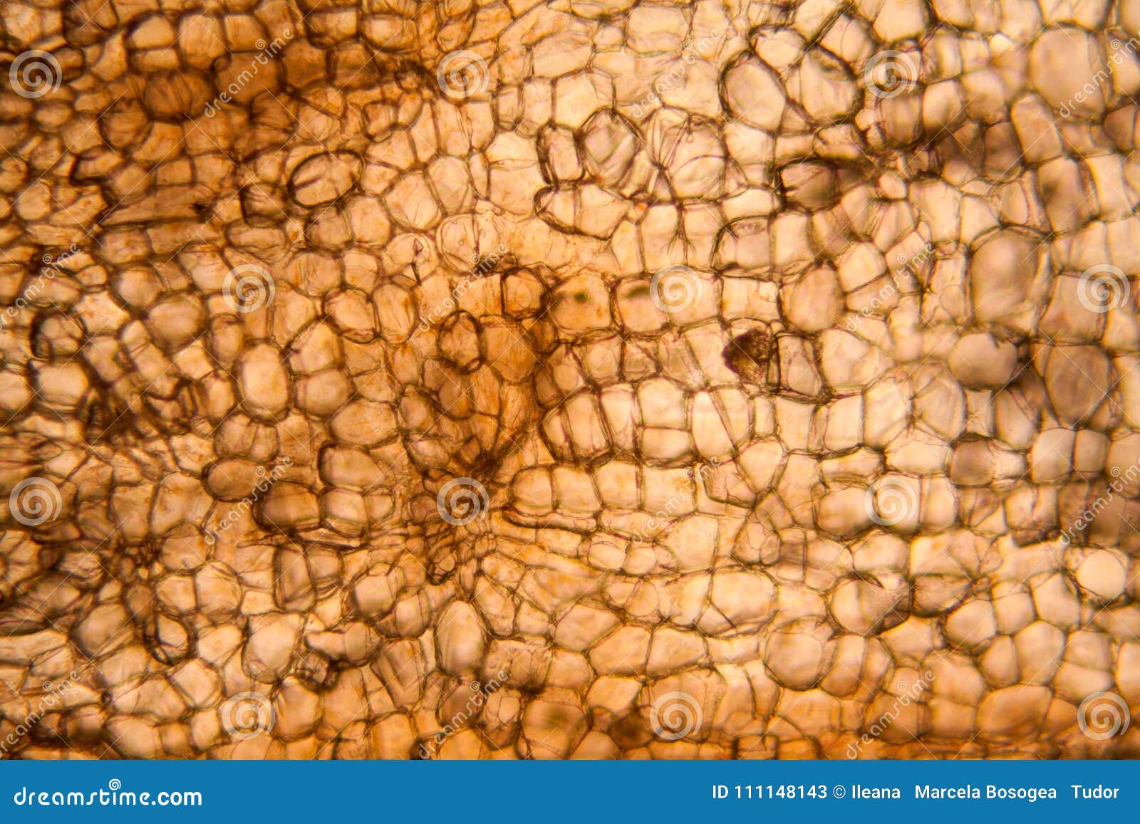 Cellule Della Carota Al Microscopio Immagine Stock - Immagine di ...