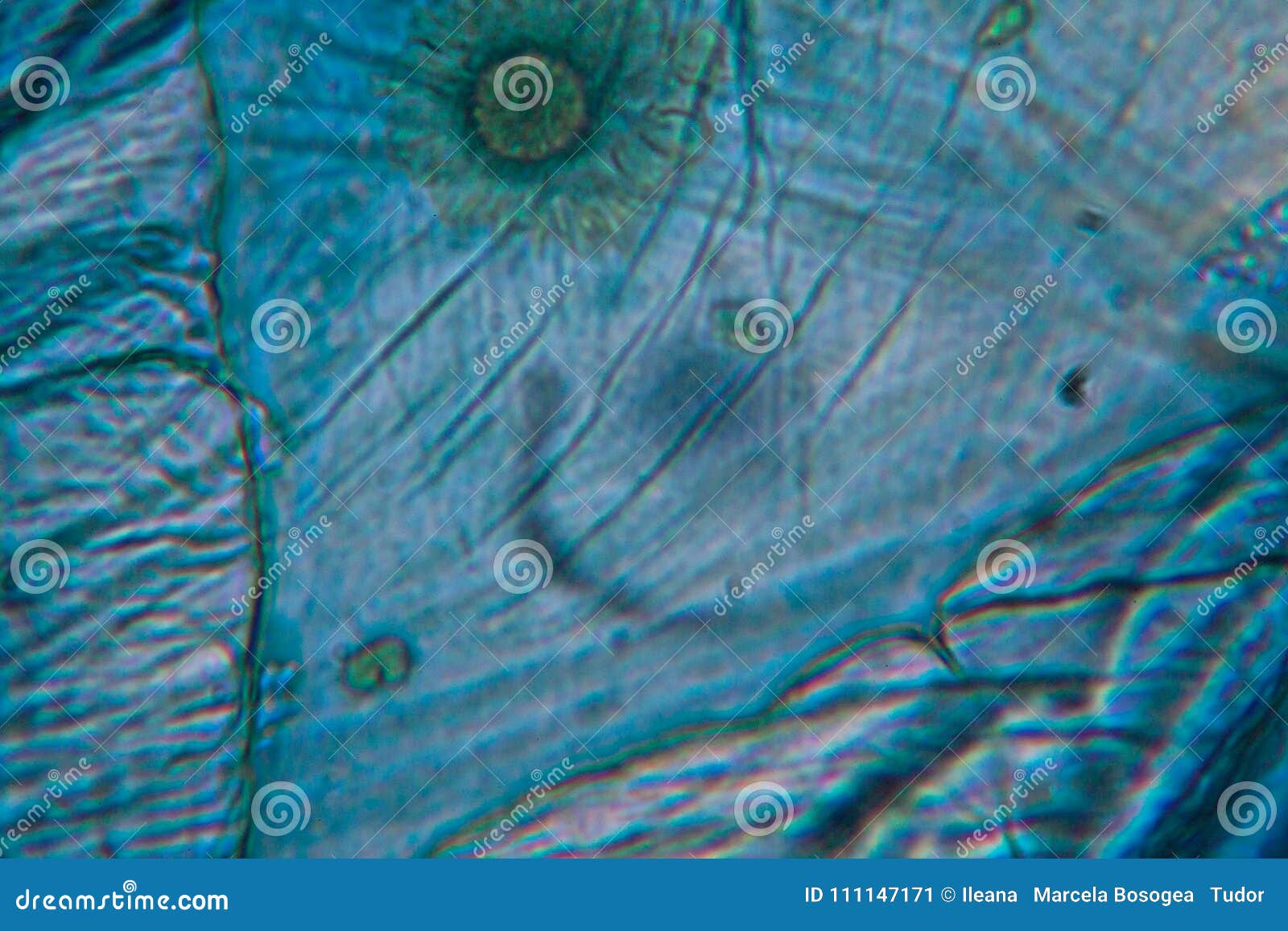 Cellule Della Cipolla Al Microscopio Immagine Stock - Immagine di ...
