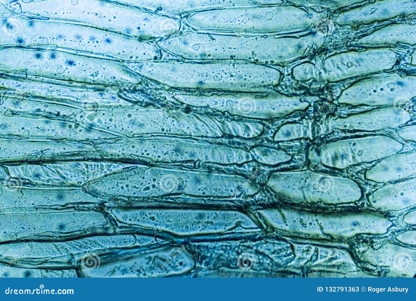 Cellule Della Cipolla Sotto Il Microscopio Immagine Stock - Immagine di ...