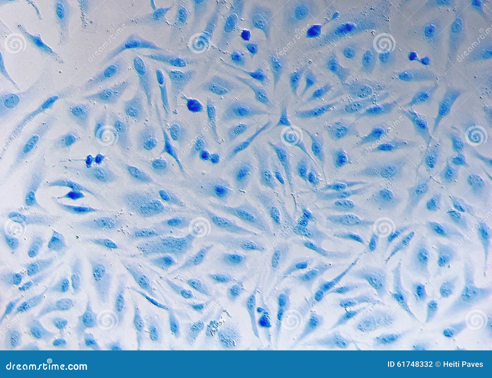 Cellule Tumorali Cervicali HeLa Fotografia Stock - Immagine di ...