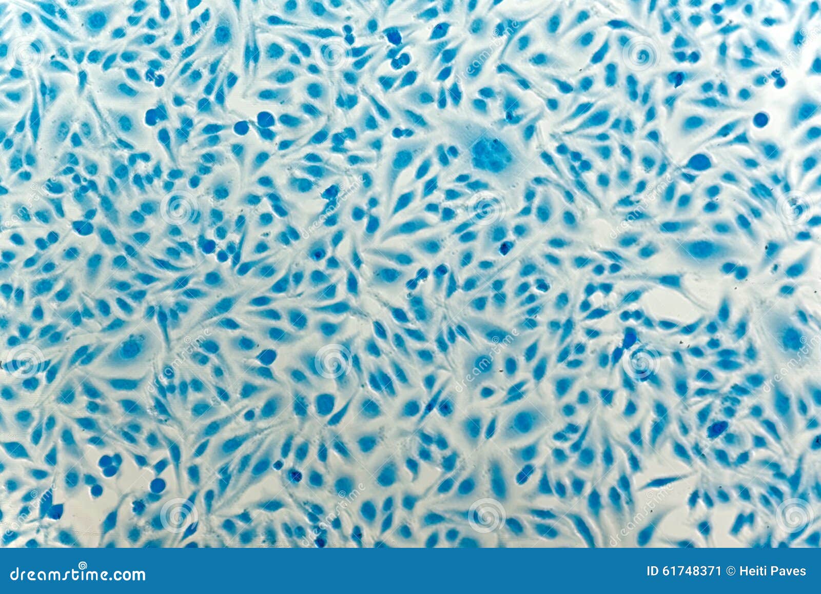 Cellule Tumorali Cervicali HeLa Immagine Stock - Immagine di nucleo ...