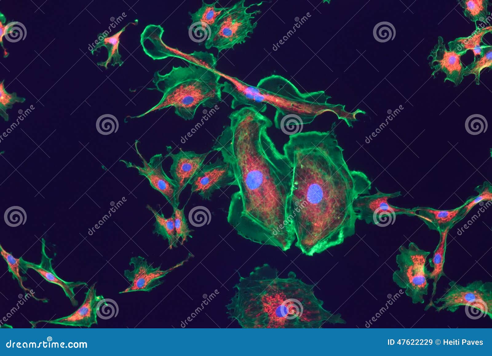 Cellules de fibroblaste image stock. Image du noyau, fibroblaste - 47622229