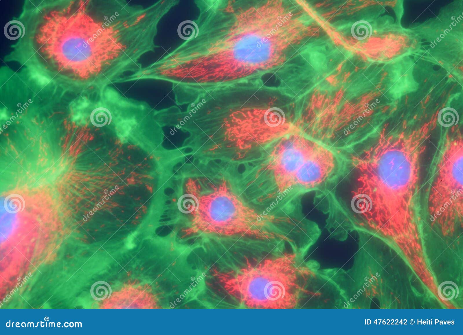 Cellules De Fibroblaste Mpressionistic Photo stock - Image du science ...