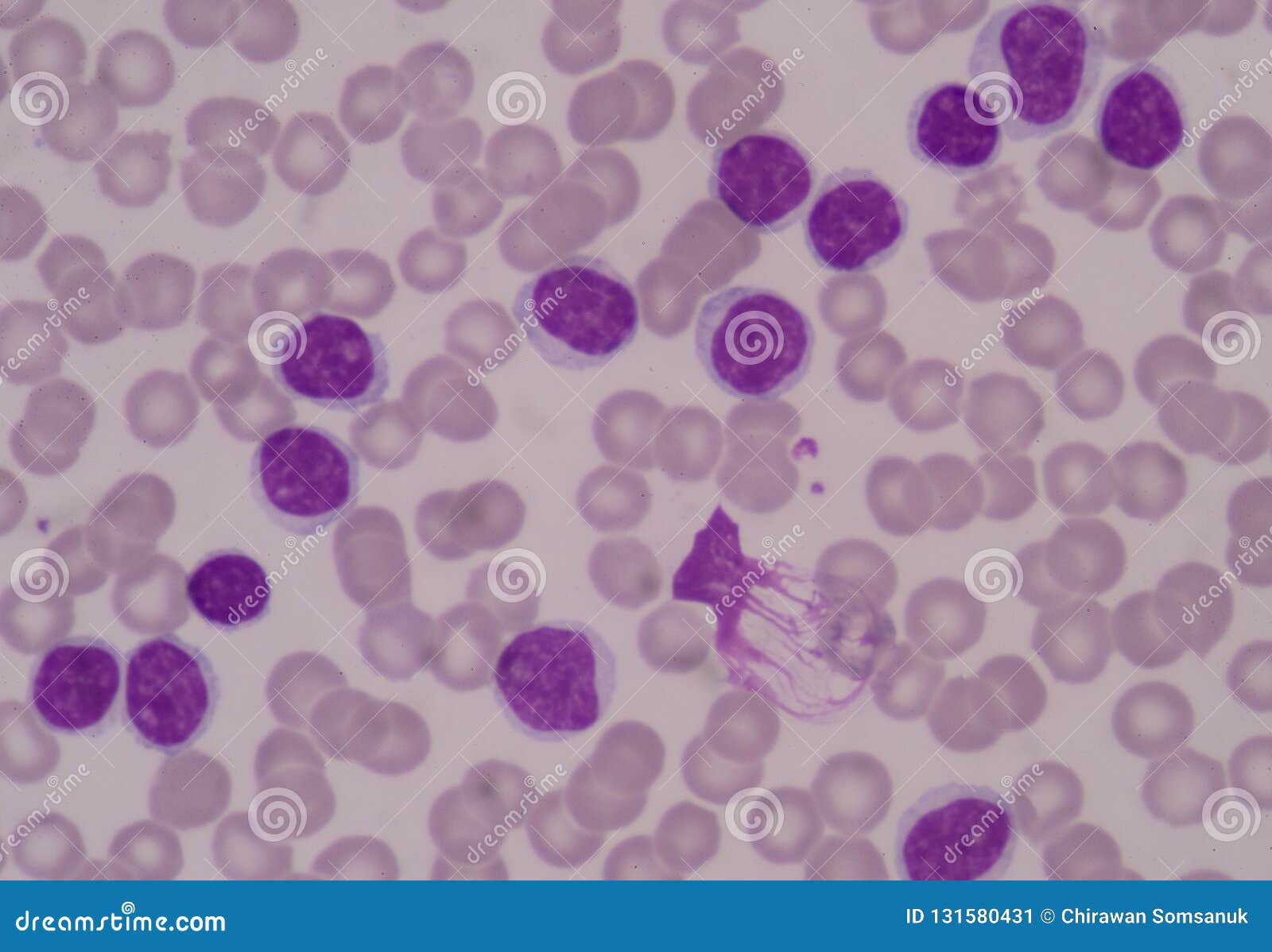 Cellules De Souffle Sur Les Globules Rouges Illustration Stock ...