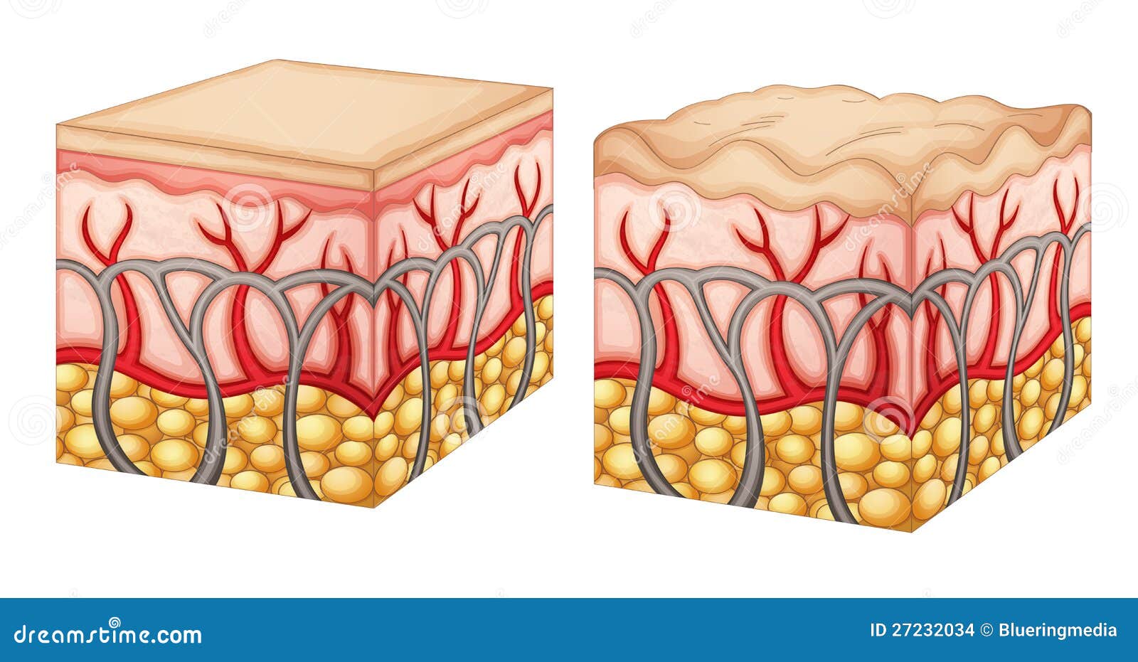Cellulite Cross Section Stock Image | CartoonDealer.com #1670947