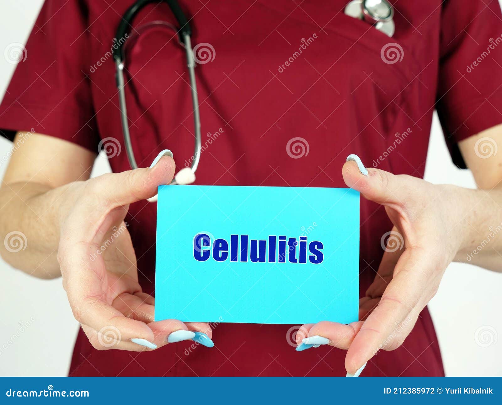 Cellulitis Phrase on the Page Stock Photo - Image of warning, symptoms ...