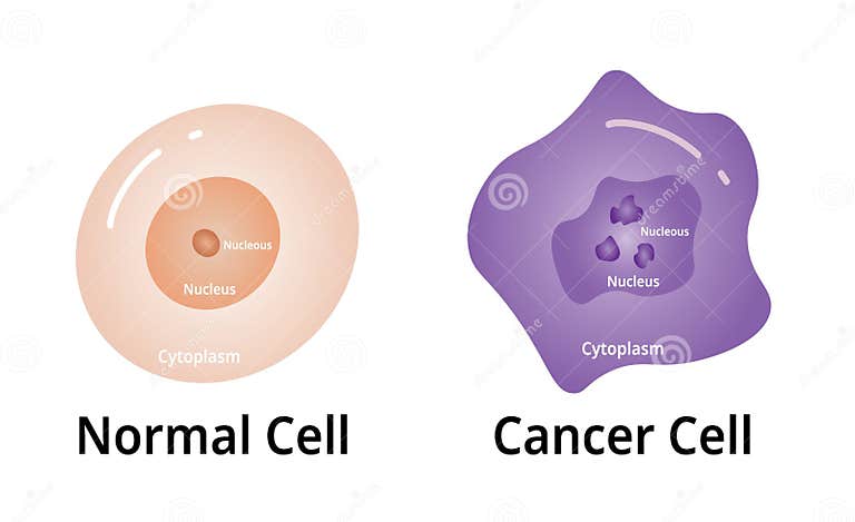 Cencer Cell, with Normal Cell Compare, Illustration Vector Stock Vector ...