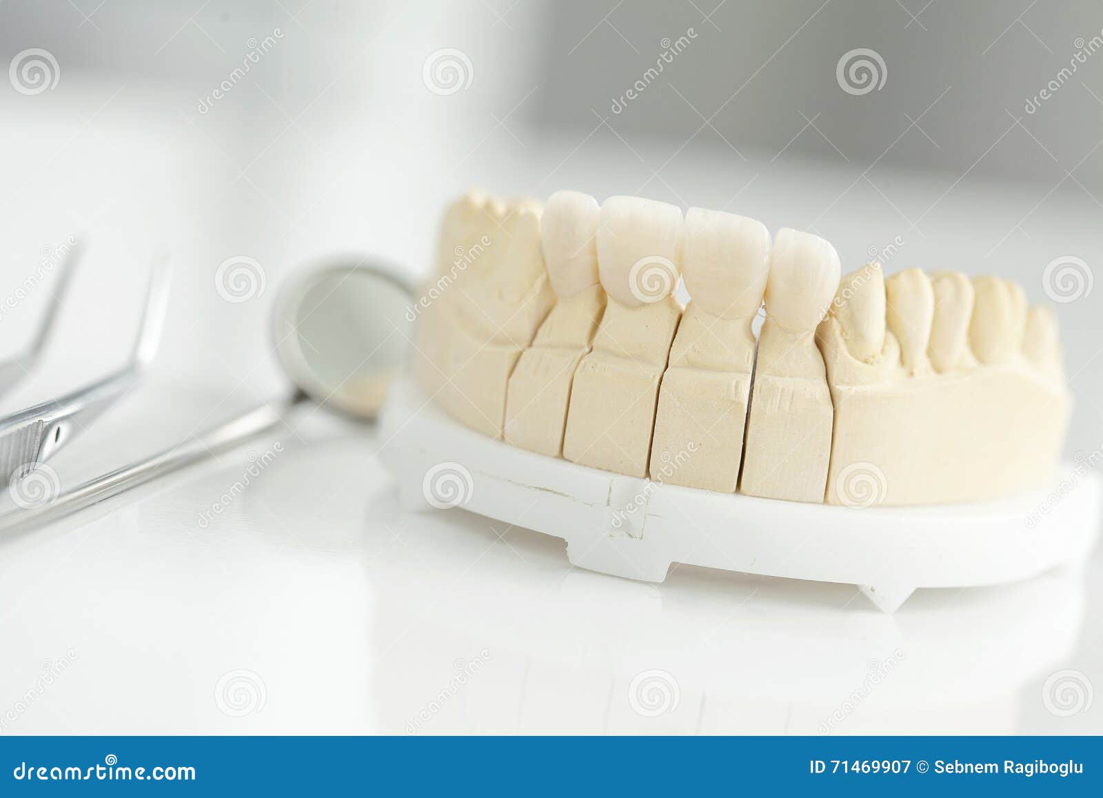Ceramic Bridge on Plaster Model Stock Image - Image of care, oral: 71469907