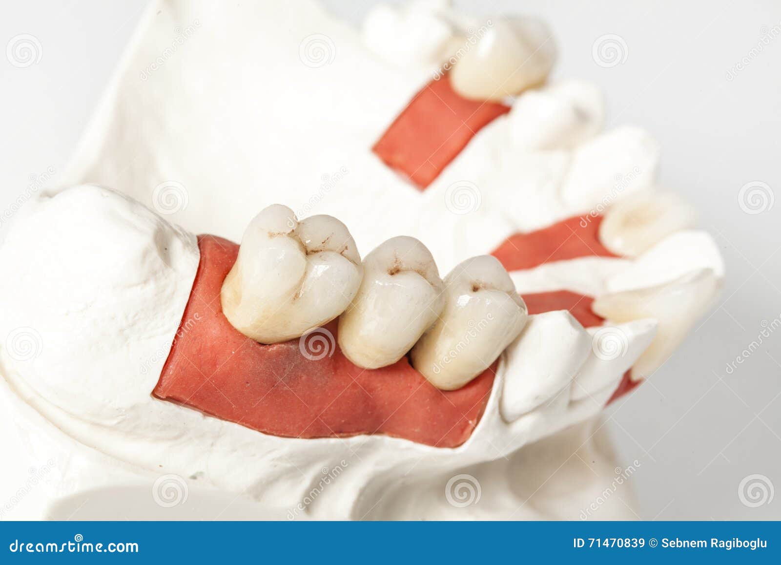 Ceramic Bridge on Plaster Model Stock Image - Image of handle, false ...