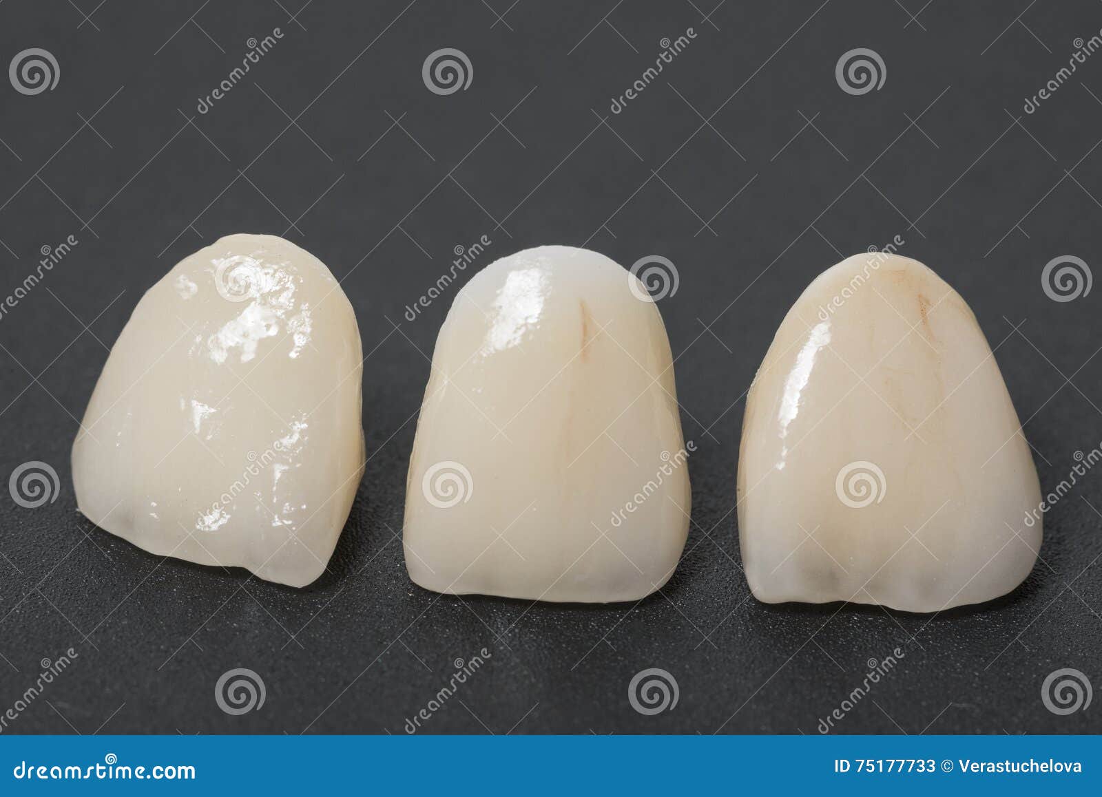 Ceramic crowns stock image. Image of medical, closeup - 75177733