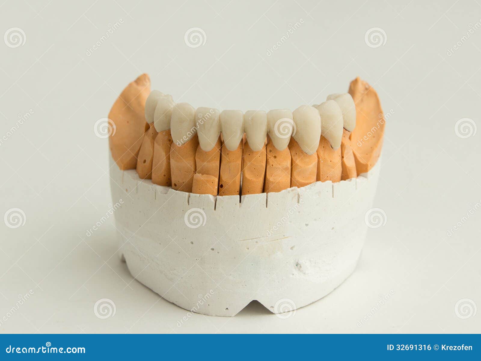 Ceramic dental crown stock photo. Image of orthodontist - 32691316