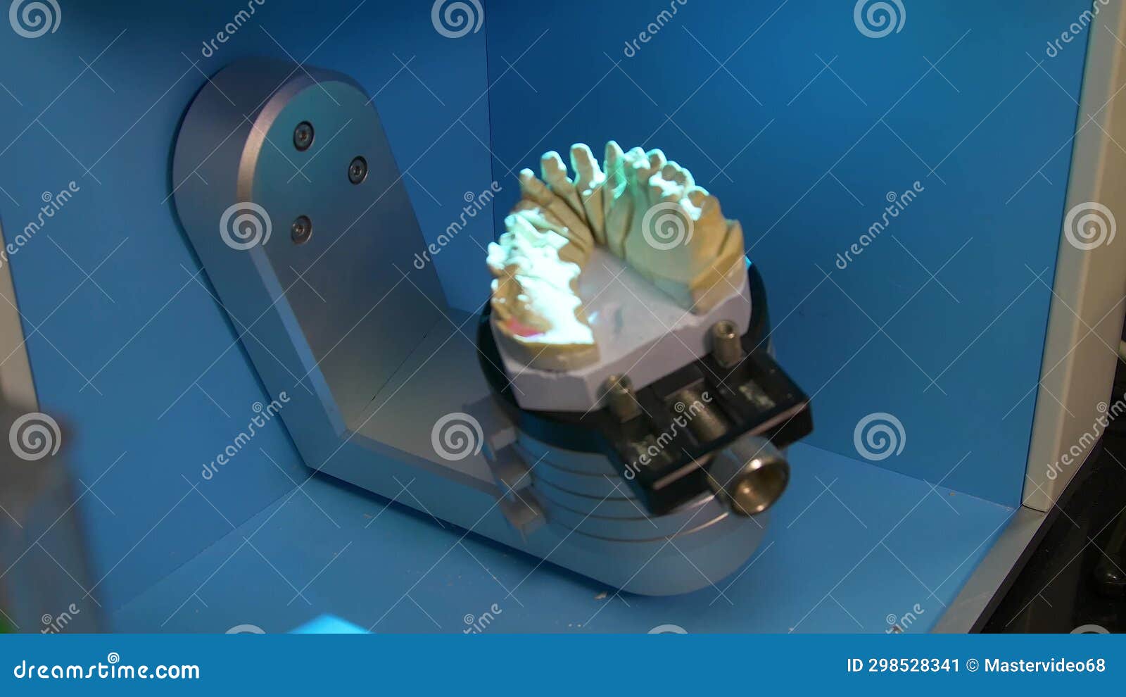 Scanning of Casts on a 3D Scanner for the Manufacture of Dentures ...