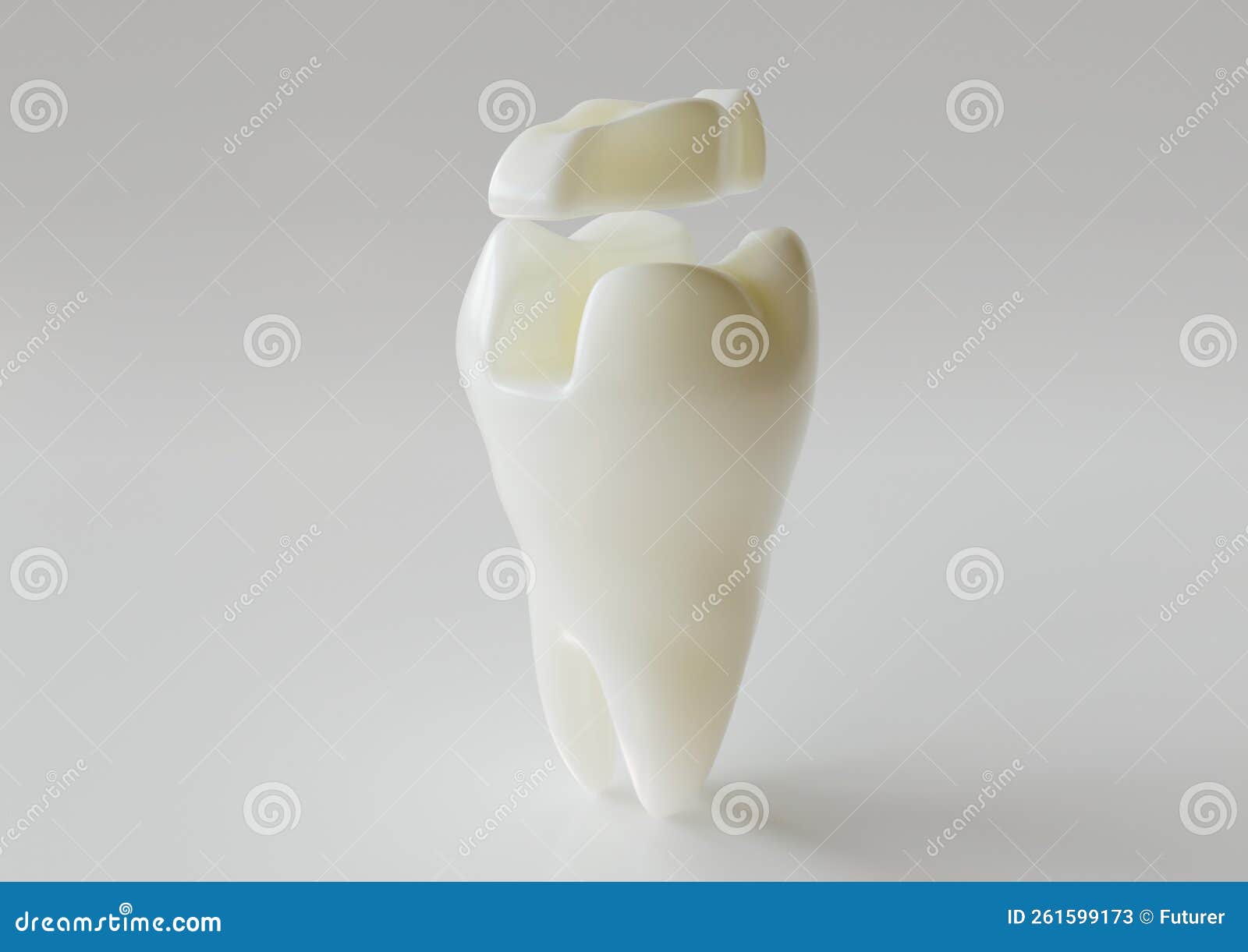 Ceramic Inlay Crown Over a Tooth- 3D Rendering Stock Illustration ...