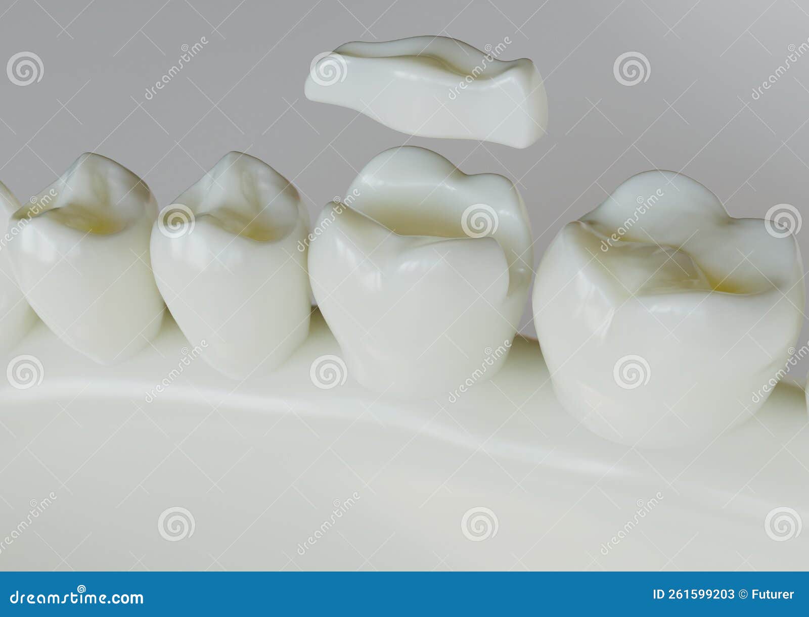 Ceramic Inlay Crown Over a Tooth- 3D Rendering Stock Illustration ...