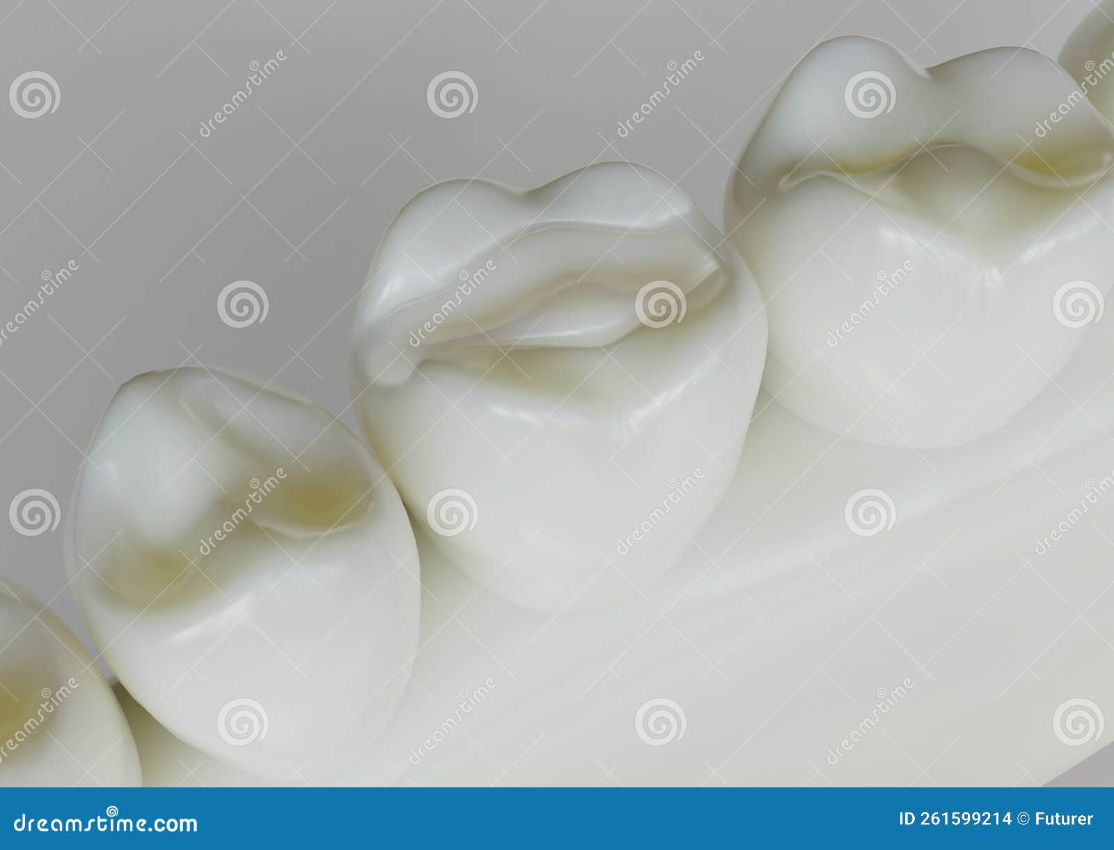 Ceramic Inlay Crown in a Tooth- 3D Rendering Stock Illustration ...