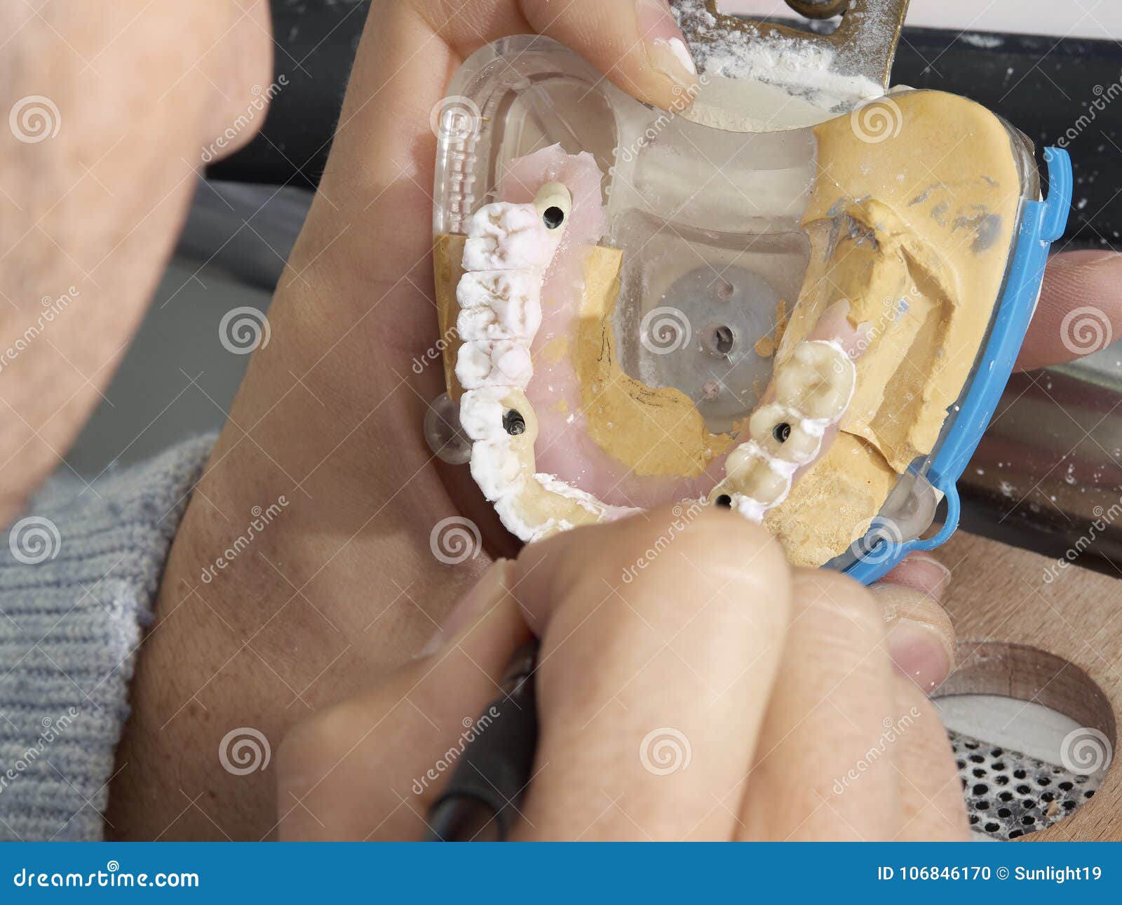 Ceramic editorial image. Image of closeup, denture, model - 106846170