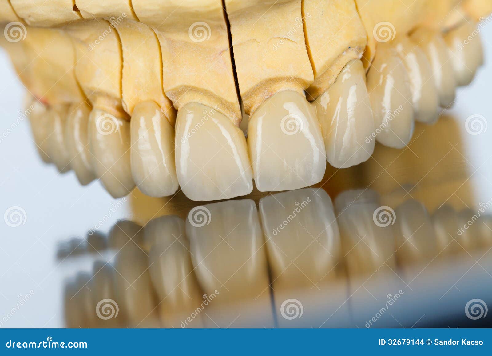 Ceramic Teeth - Dental Bridge Stock Photo - Image of prosthetics ...