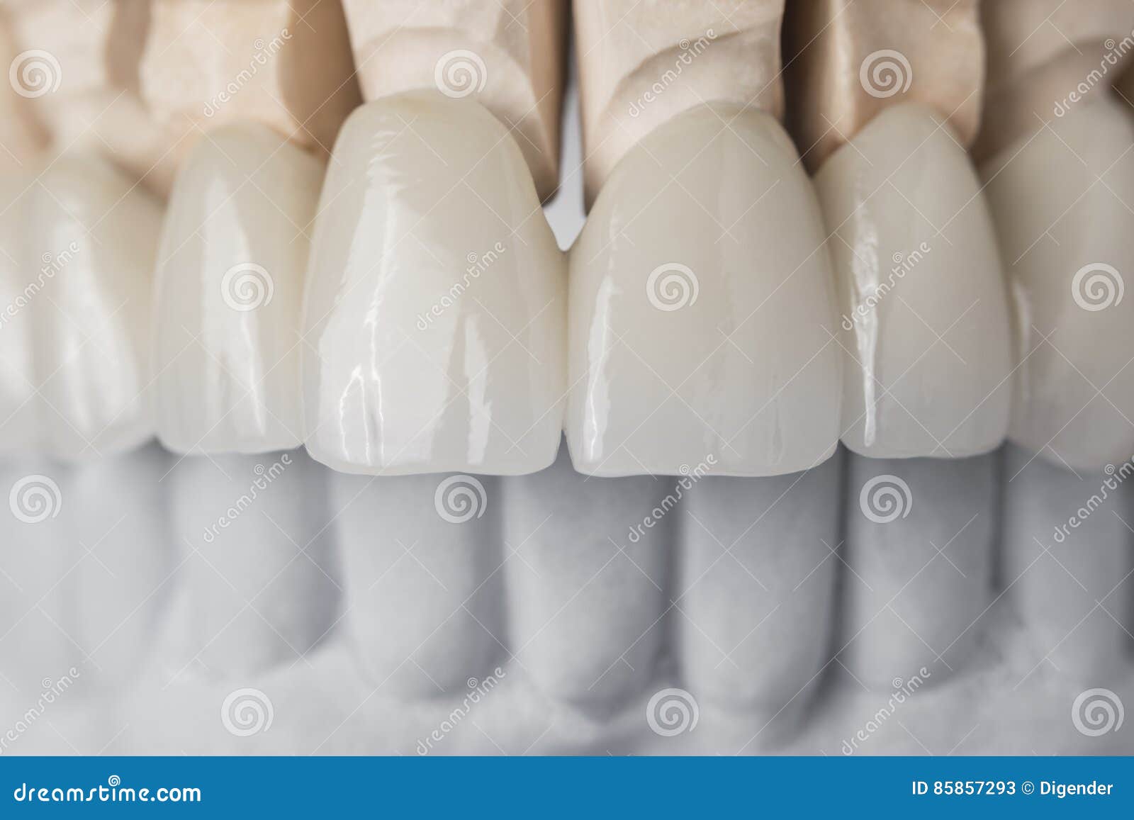 Ceramic teeth in the front stock image. Image of prosthodontia - 85857293