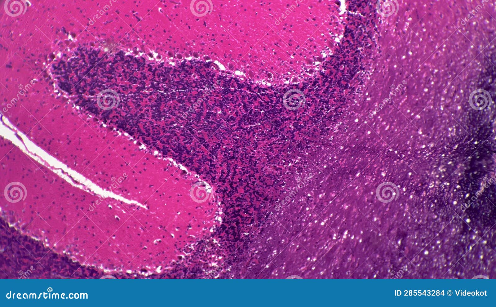 Cerebellar Cortex of Human Filmed Under Light Micrograph 100x on Bright ...