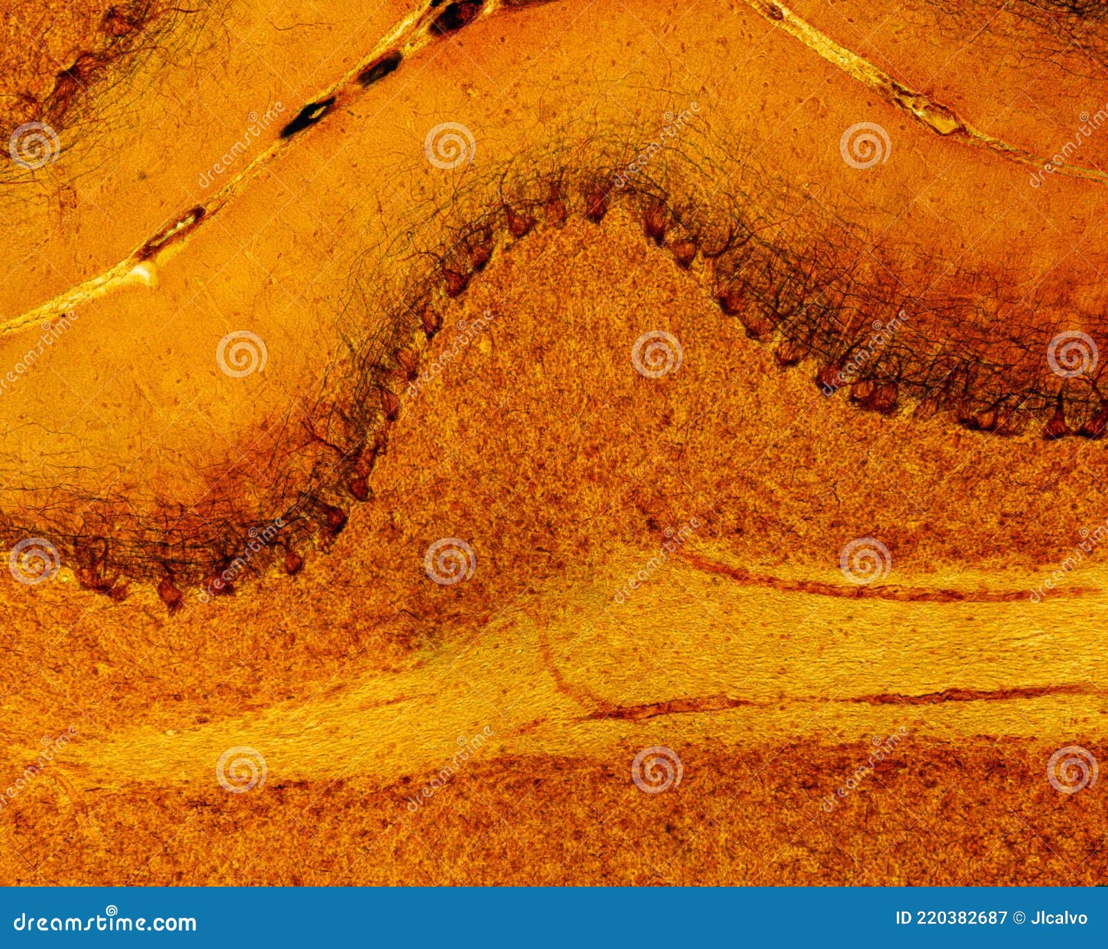 Cerebellar Cortex. Silver Stain Stock Image - Image of purkinje ...