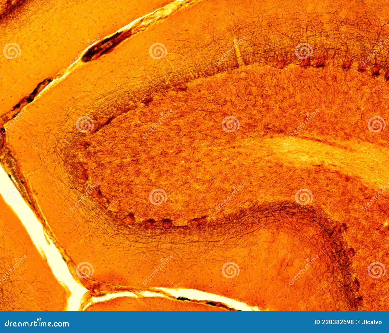 Cerebellar Cortex. Silver Stain Stock Photo - Image of matter, cells ...