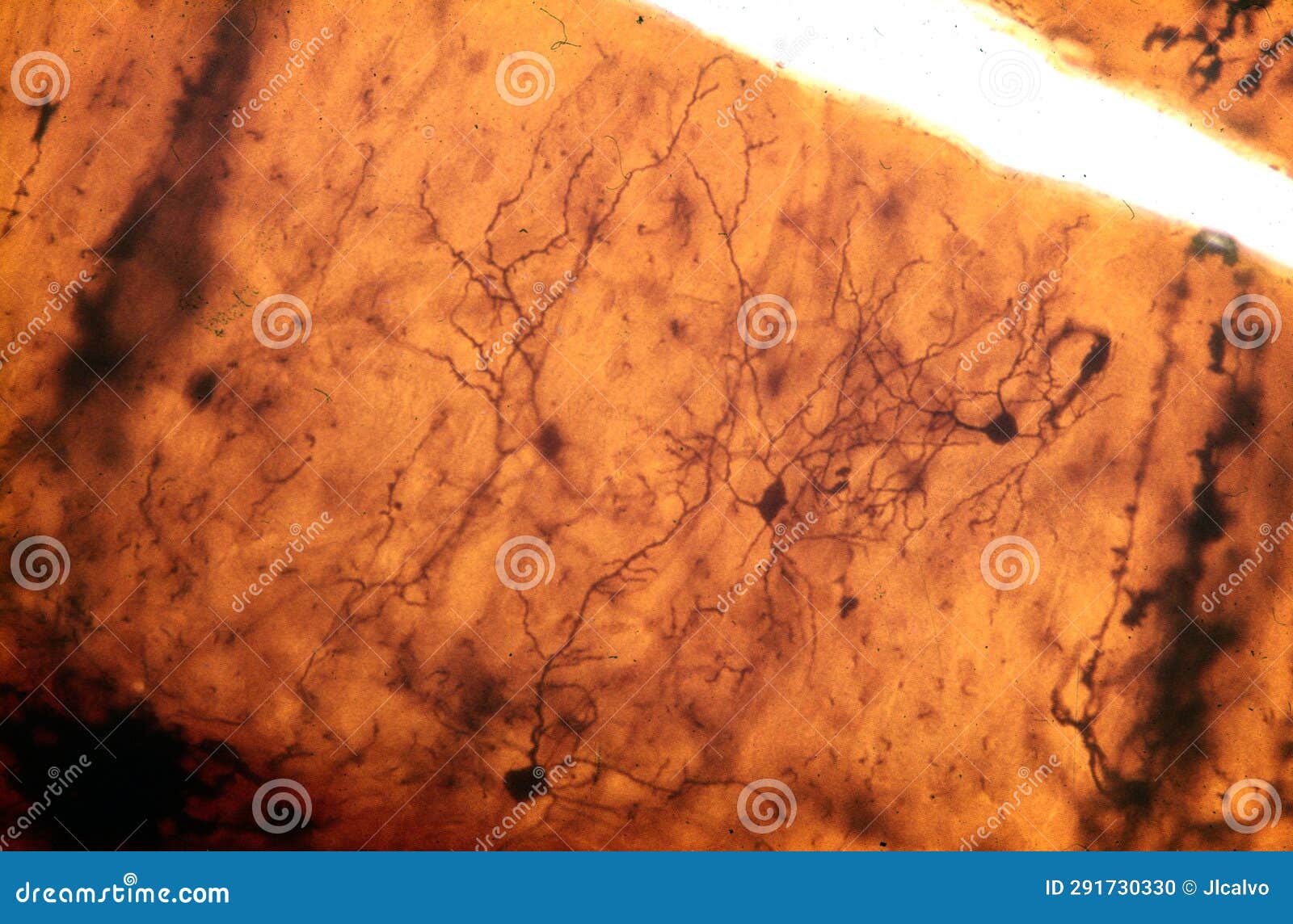 Cerebellar Cortex. Stellate Cells Stock Photo - Image of light, neuron ...