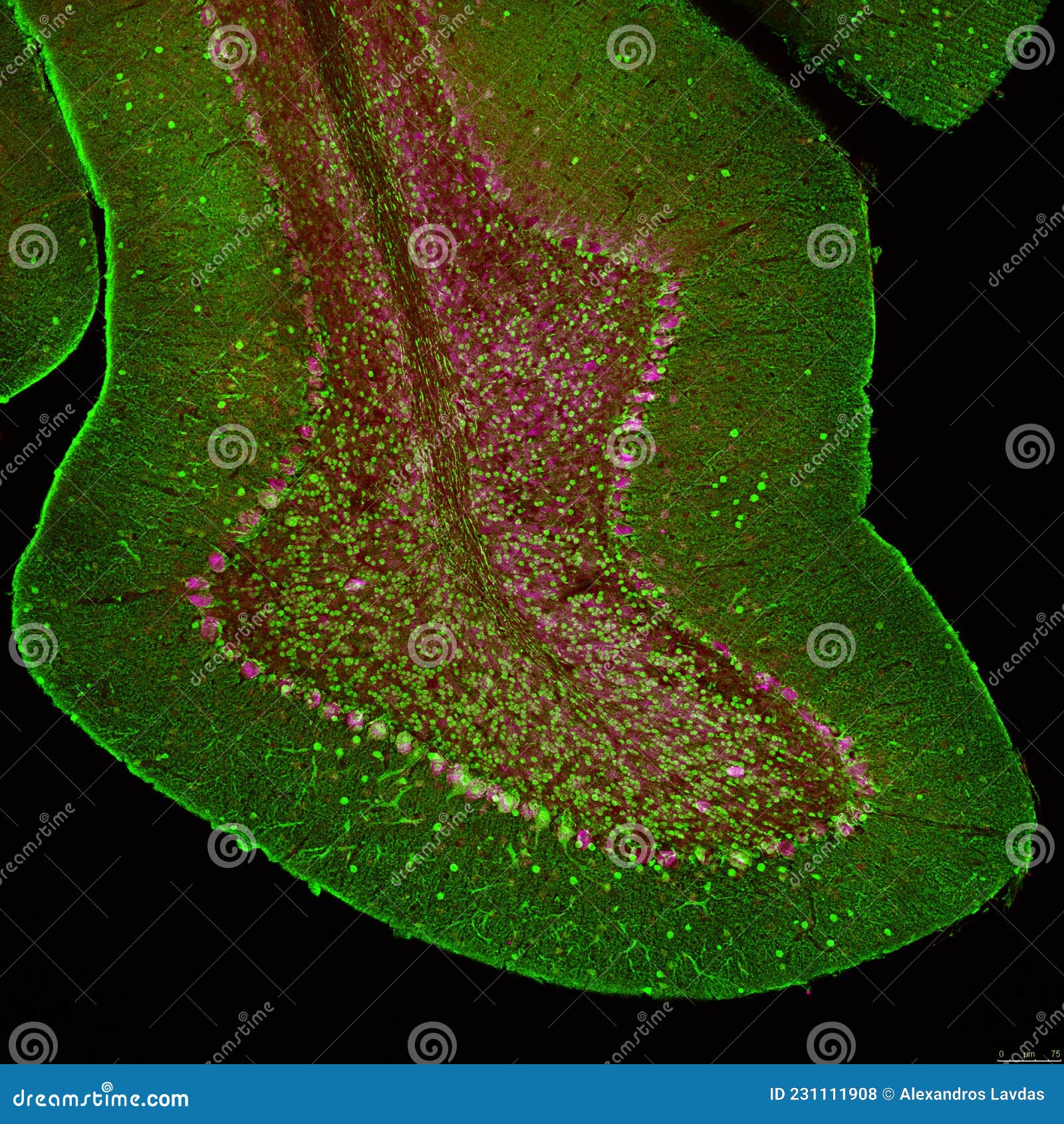 Cerebellar Folium, Confocal Image Stock Photo - Image of scanning ...
