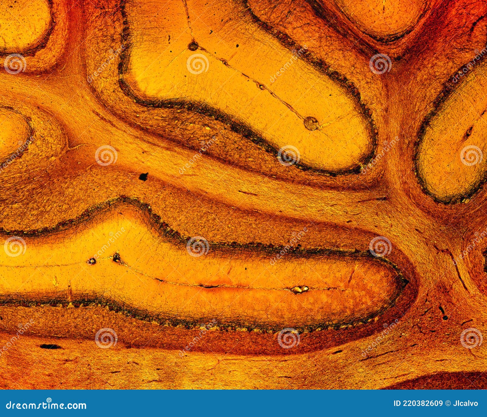 Cerebellum. Silver Stain Royalty-Free Stock Photography | CartoonDealer ...