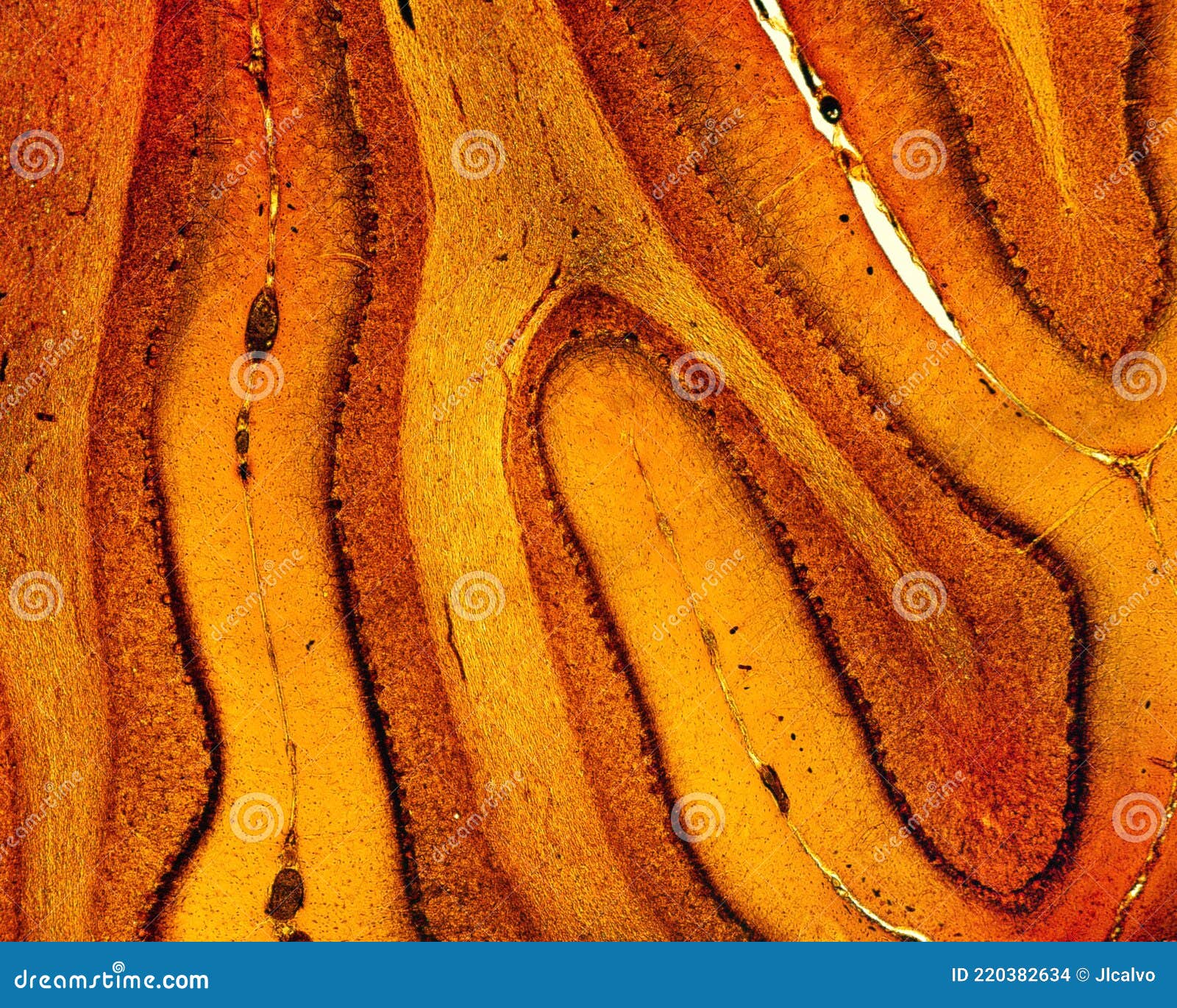 Cerebellum. Silver Stain Stock Photo | CartoonDealer.com #220382634