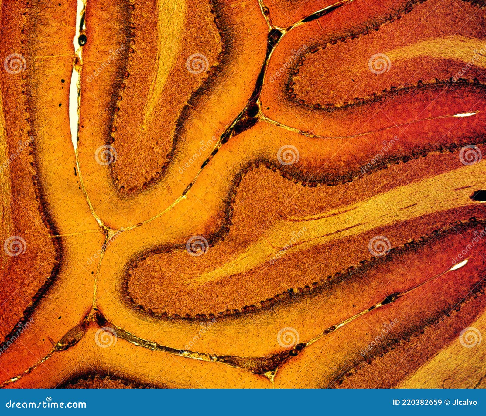 Cerebellum. Silver stain stock image. Image of neurology - 220382659