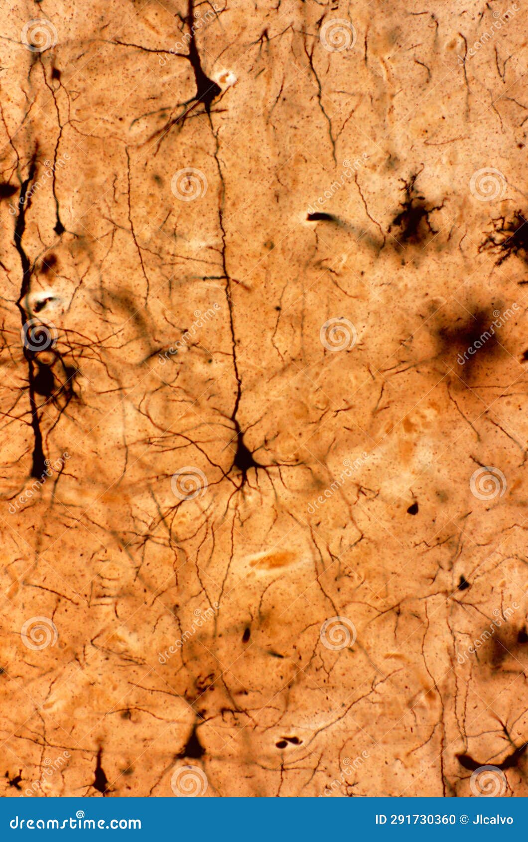 Cerebral Cortex. Pyramidal Neuron Stock Photo - Image of brain ...