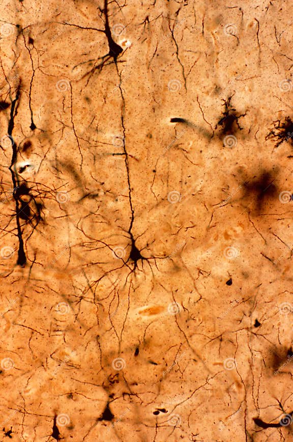 Cerebral Cortex. Pyramidal Neuron Stock Photo - Image of brain ...