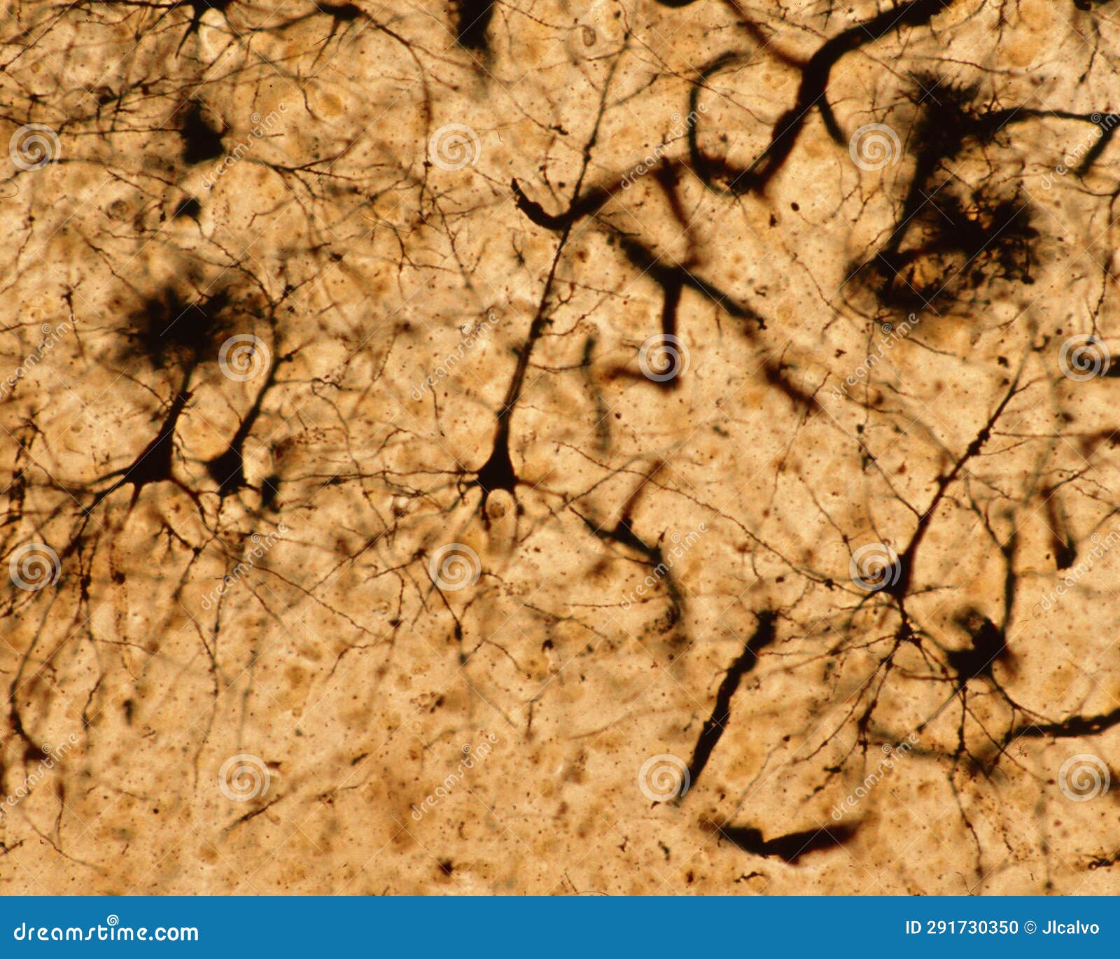 Cerebral Cortex. Pyramidal Neurons Stock Photo - Image of microscope ...